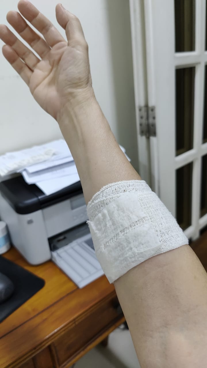 The Cow Bite story continues (after 74 hours) - AnimalCare